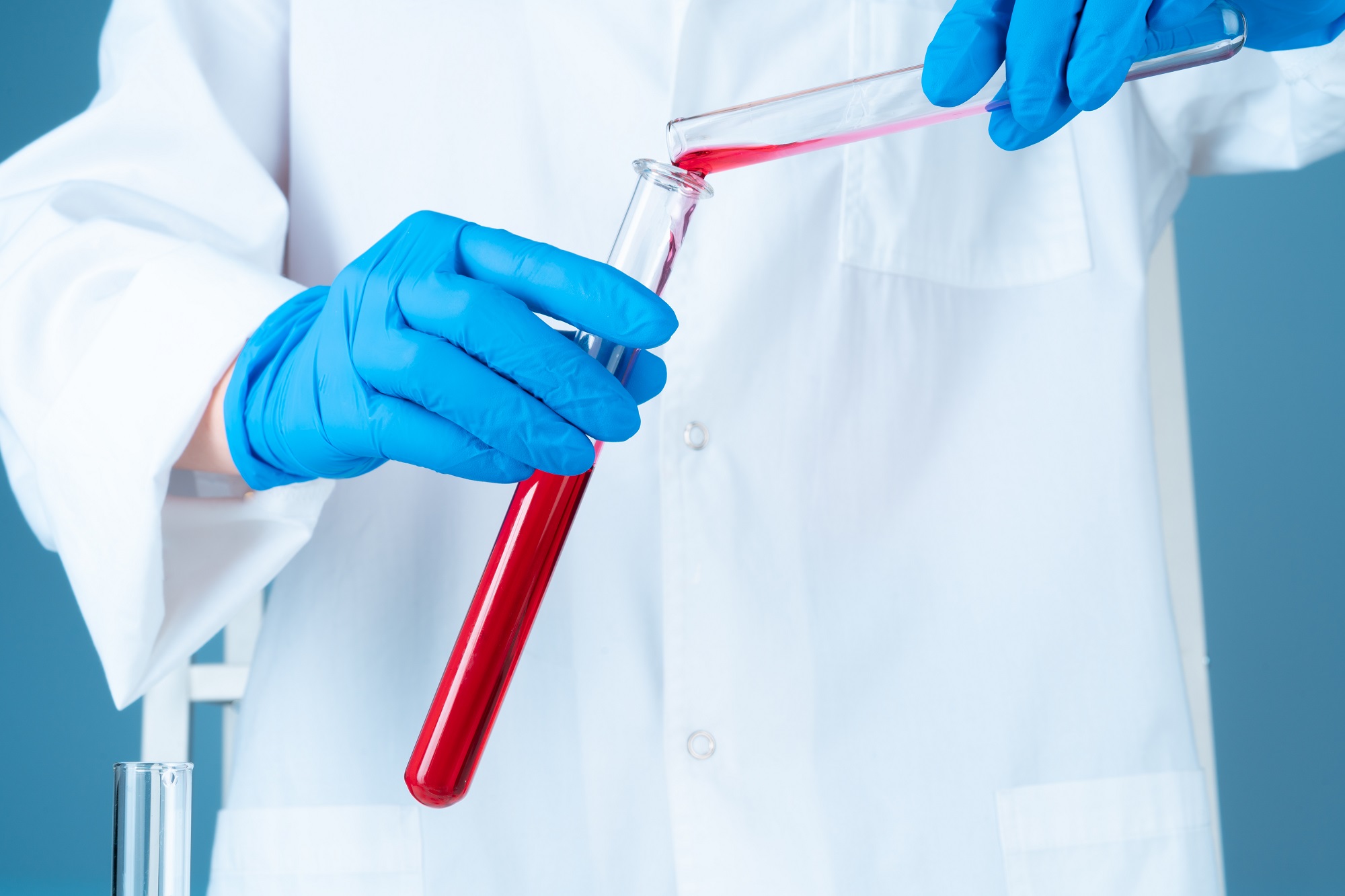 Cancer Antigen Test: CA-125 Blood Test - Health Tips | Health Blog ...