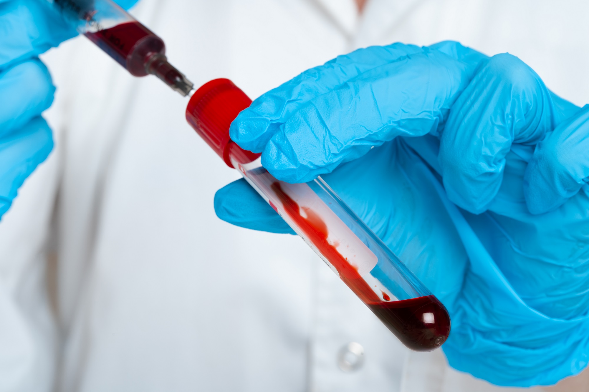 Home Sample Collection: A Game-Changer in Healthcare - Health Tips ...