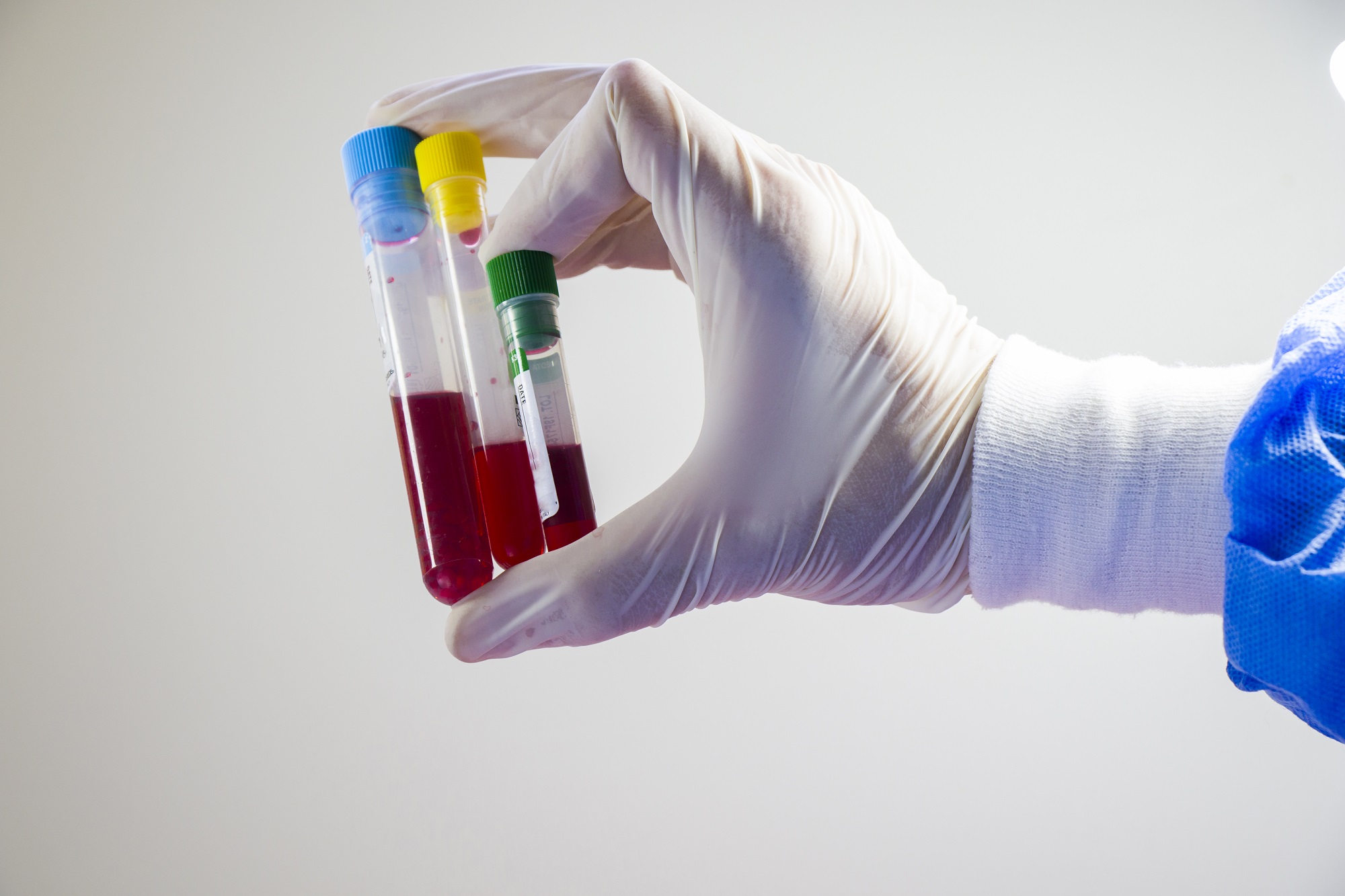 Unlocking the Power of Home Blood Tests: CBC, LFT, KFT, HbA1c, Thyroid ...