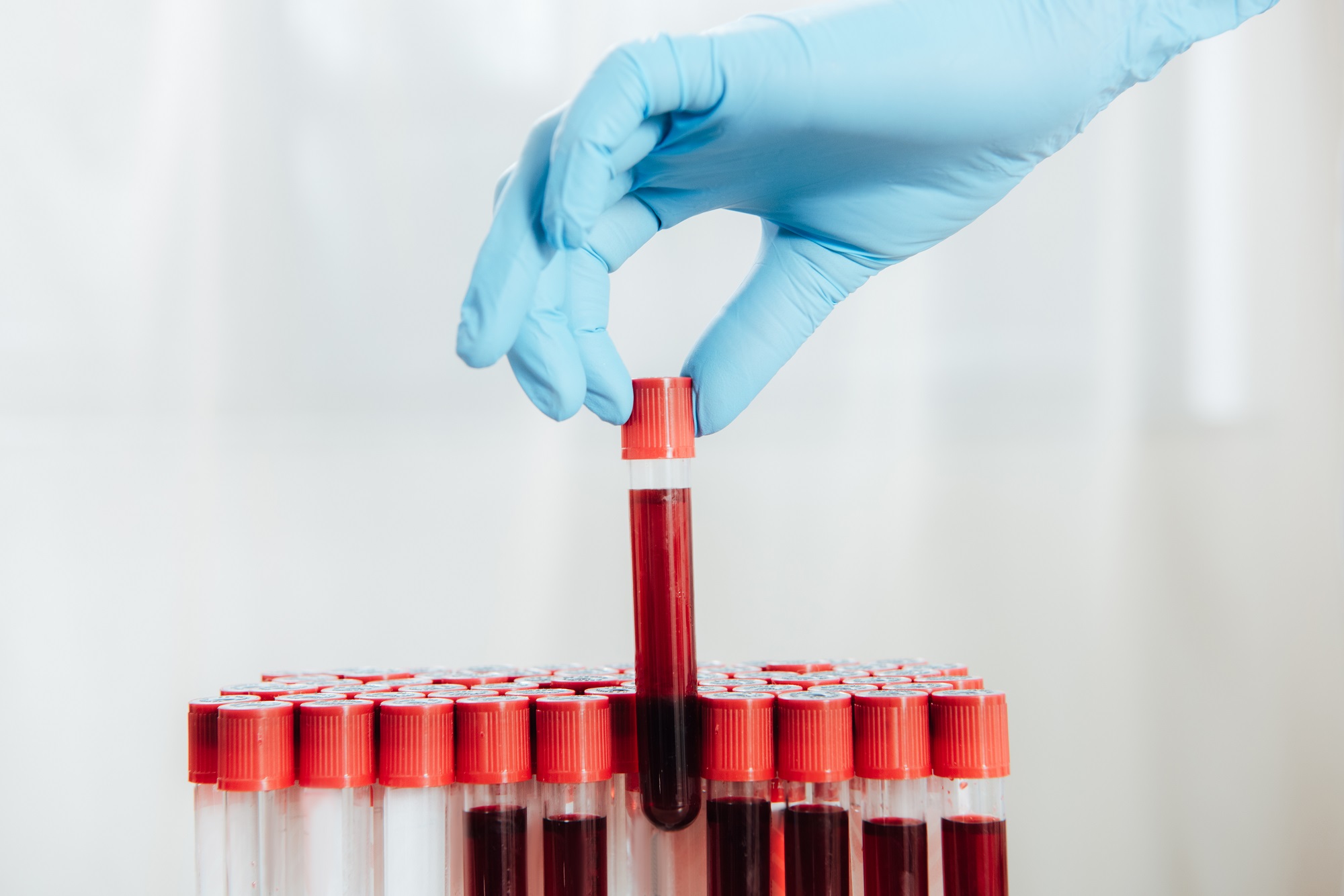 ESR Blood Test Near Me | Erythrocyte Sedimentation Rate (ESR) Blood ...