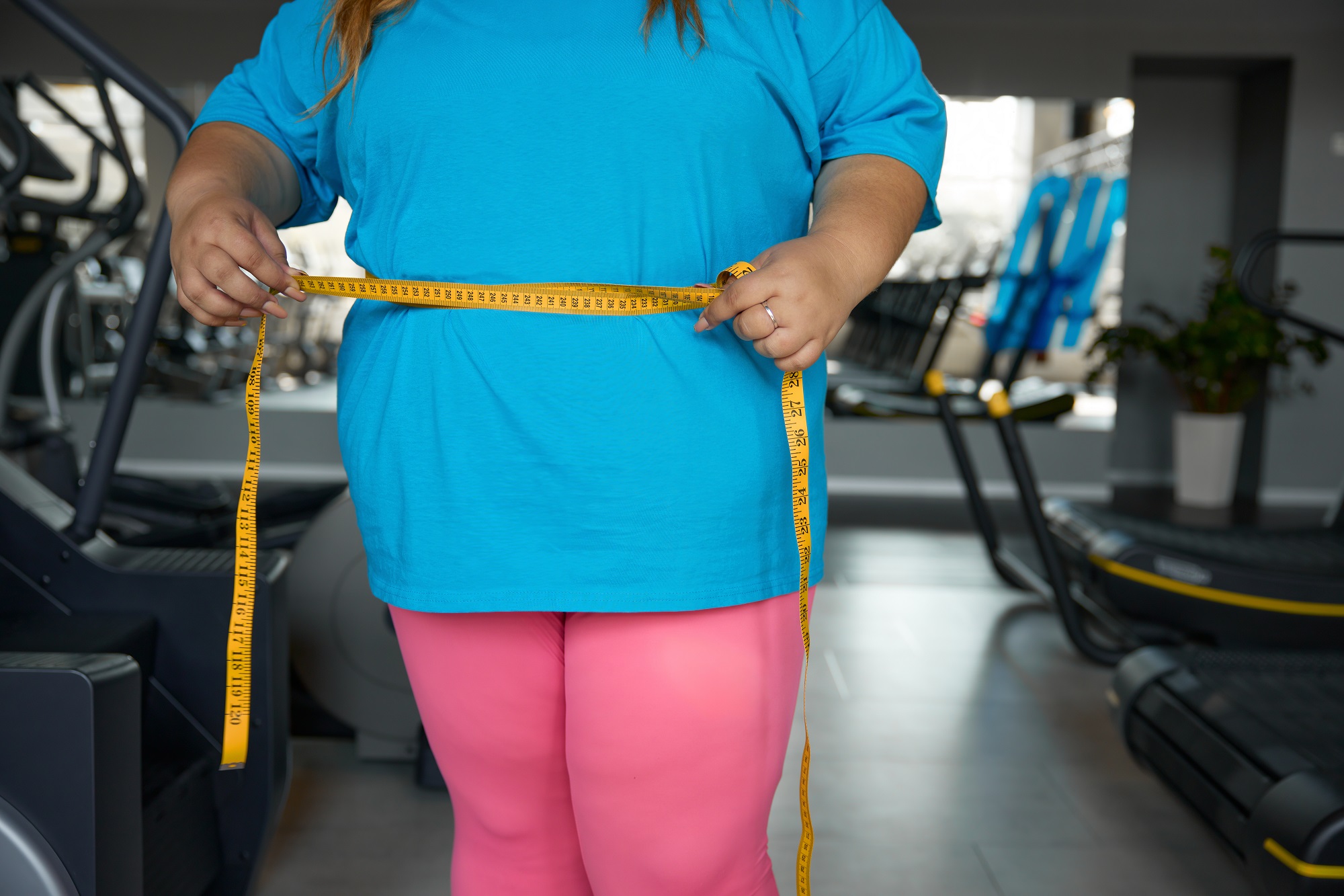 The Weight of the Matter: Top 10 Key Facts on Obesity-Related Health ...