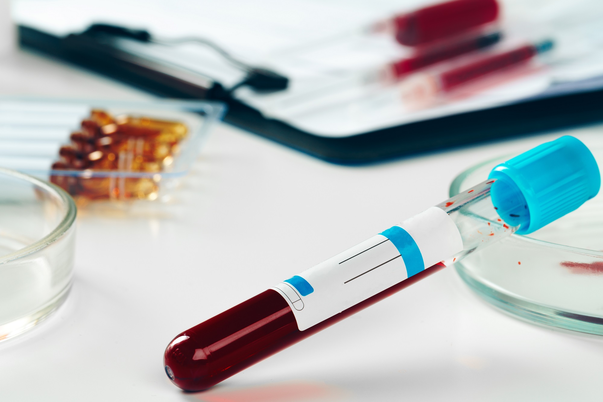 Best Blood Testing Lab Near Me | Blood Test at Home - Health Tips ...