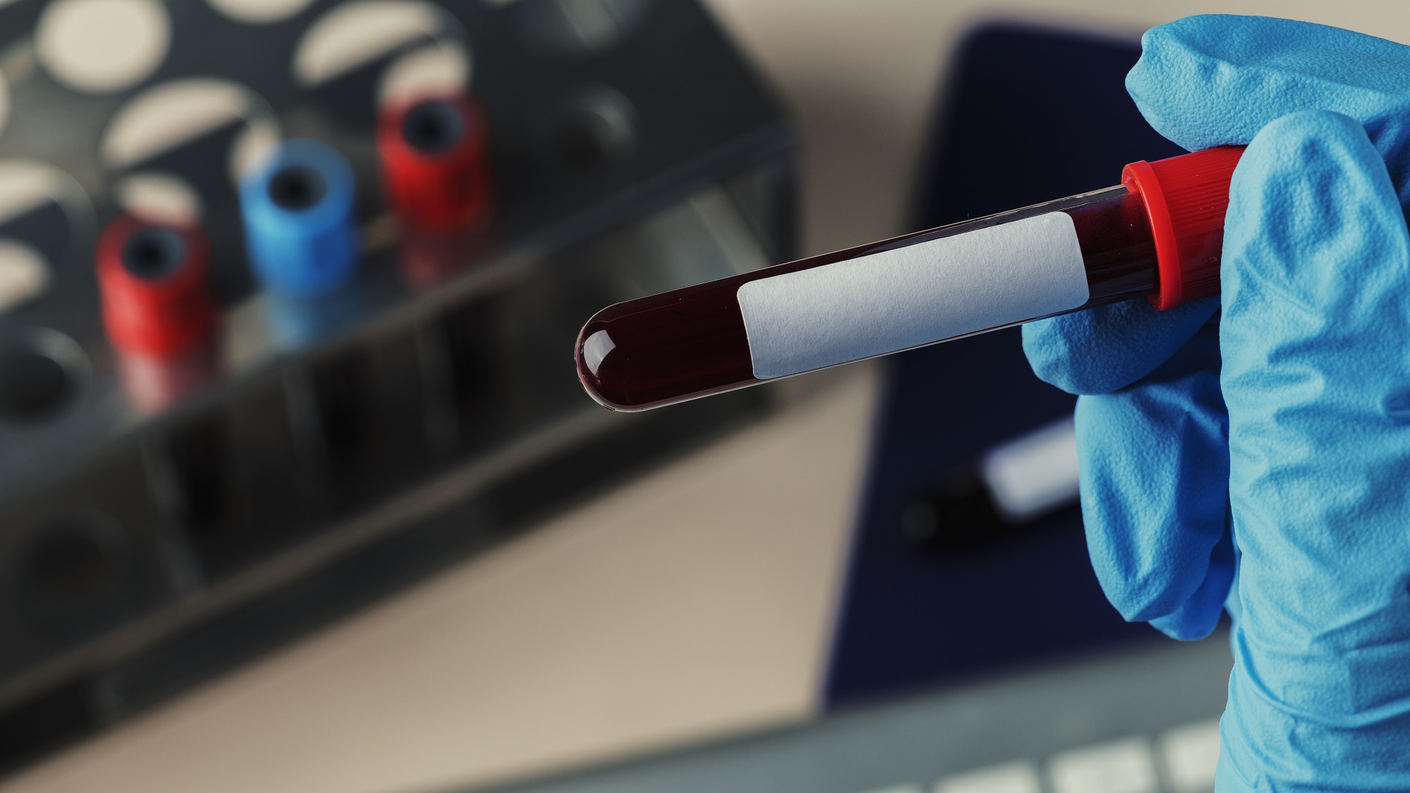 Blood Tests: Your Window to Wellness - Diagnosing and Preventing ...