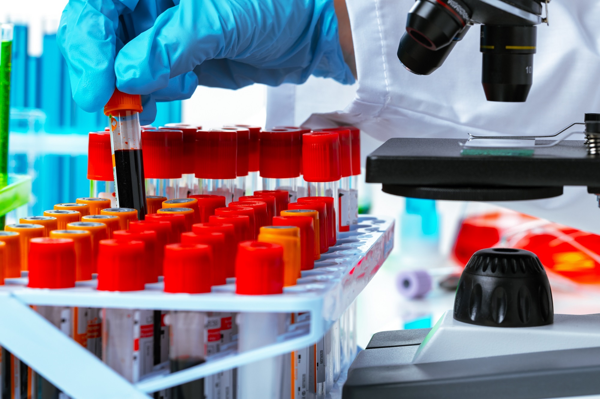 Get All Kinds of Blood Tests Done at Home: Your Comprehensive Guide ...