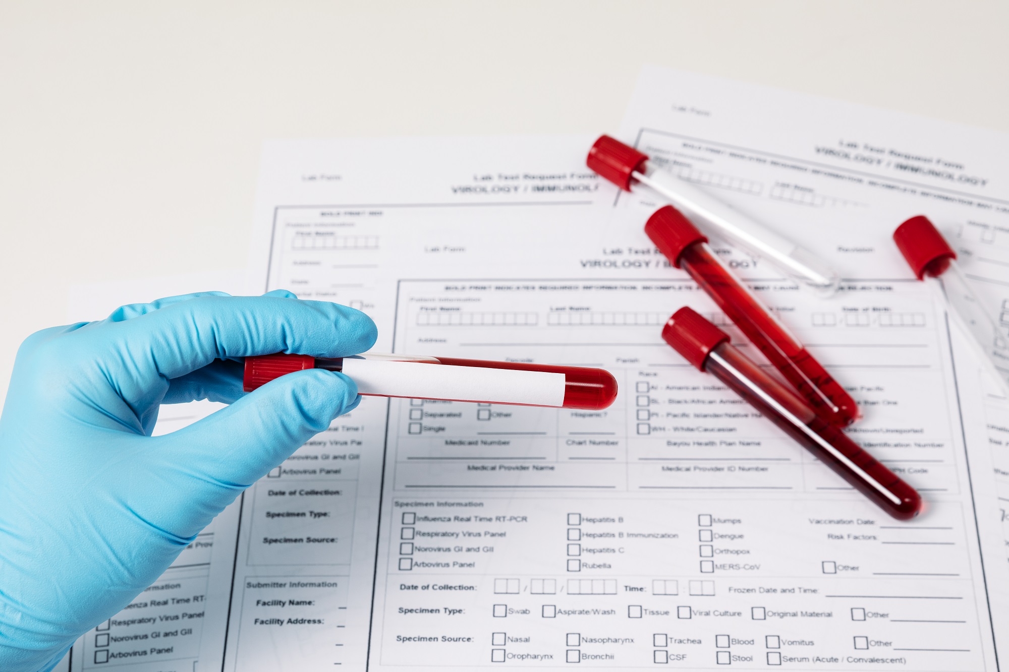 LFT Blood Test at Home | Book Liver Function Test (LFT) Online - Health ...