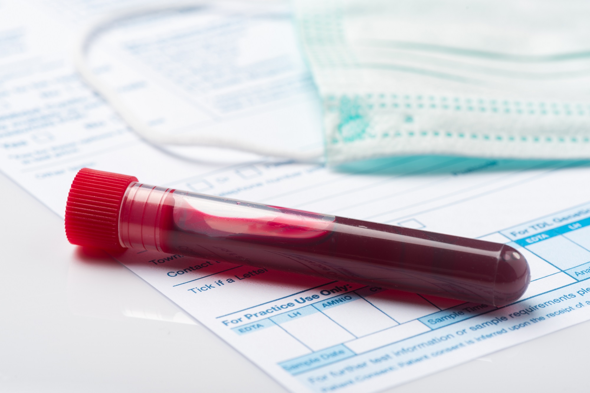Thyroid Test at Home | Book TSH, T3, T4 Test Online: Your Comprehensive ...