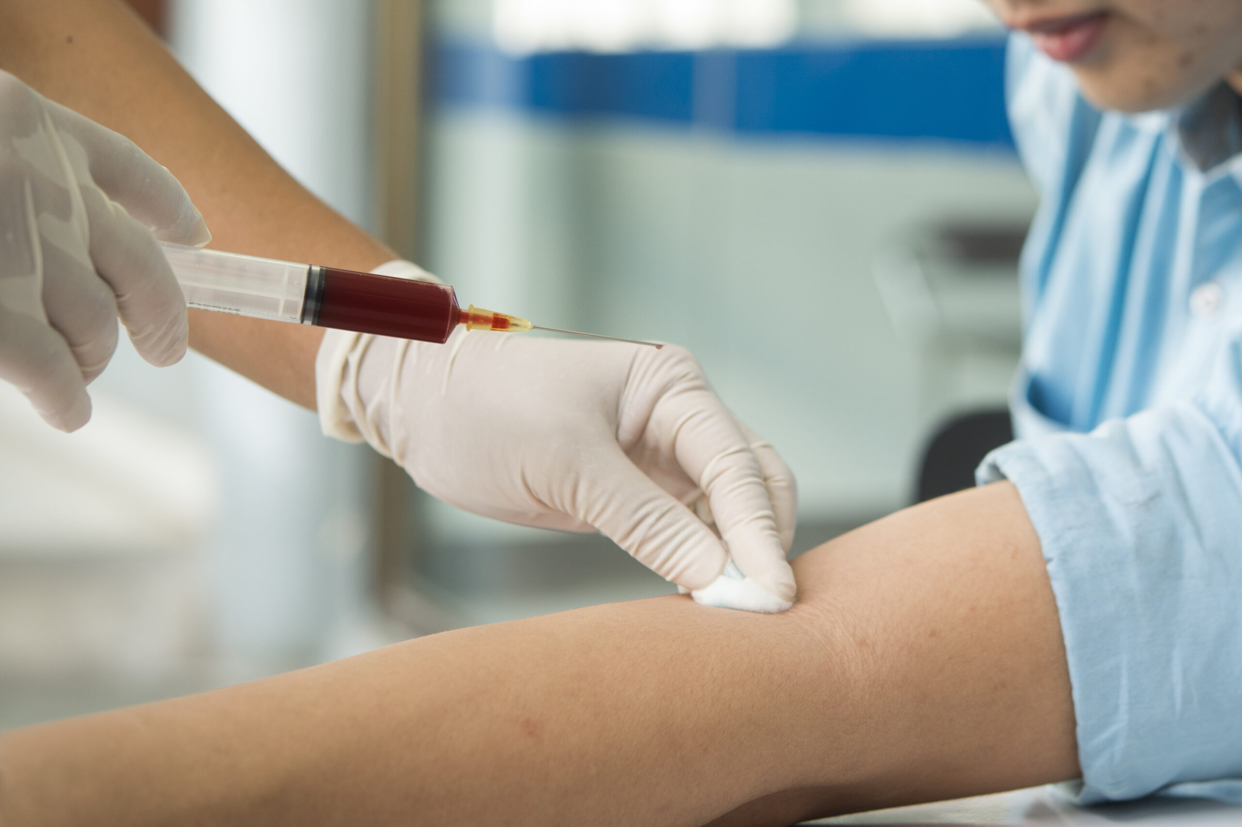 Comprehensive Lab Tests at Home: FBS, CBC, LFT, KFT, Lipid, Thyroid ...