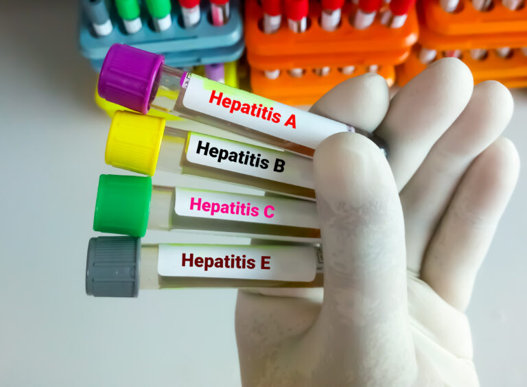 Types of Hepatitis A, B, C, D, and E: Symptoms, Transmission & How to ...