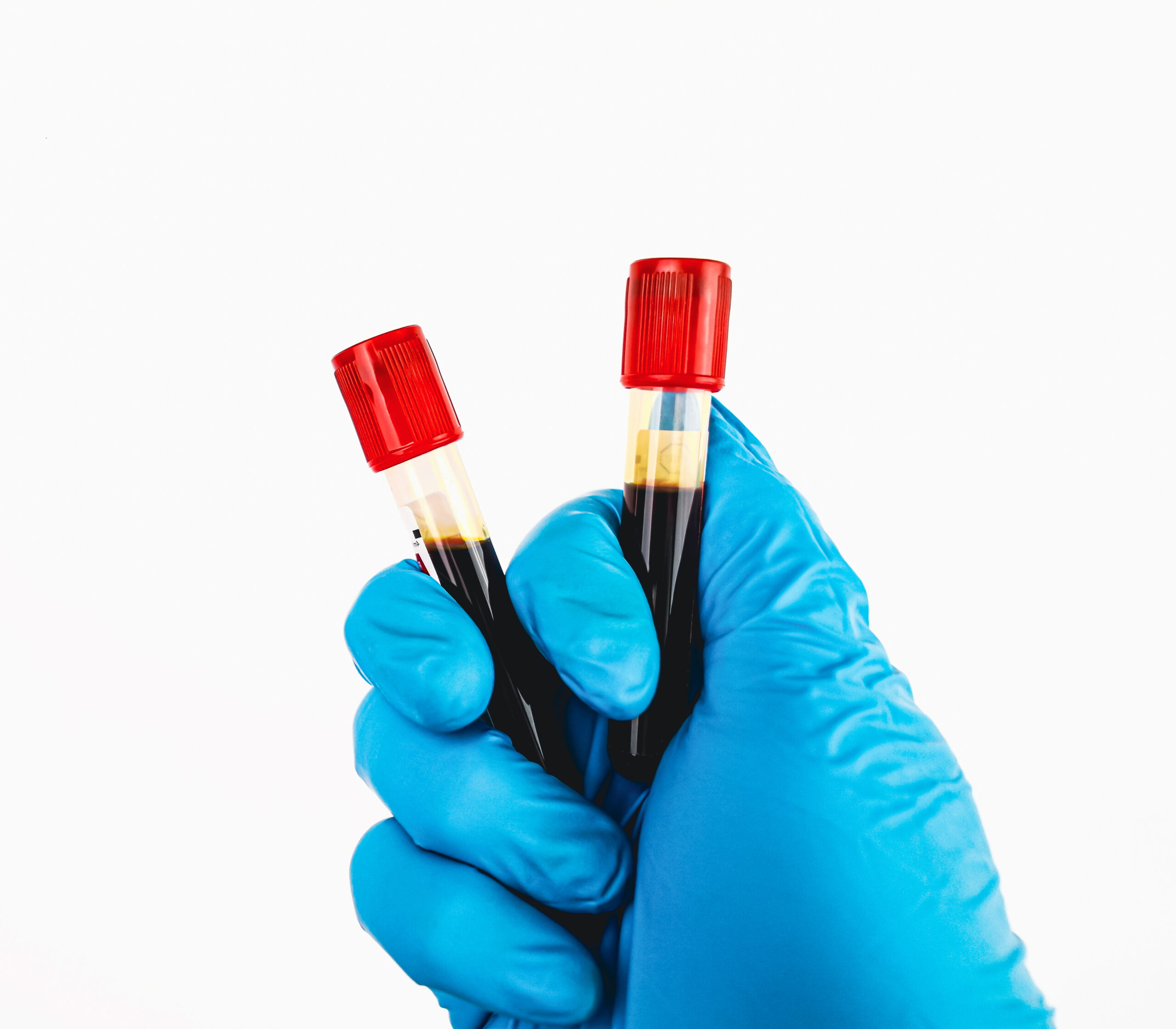Blood Culture Test: Why It’s Done, How It Works, and What It Detects ...